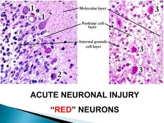 Cns response to injury | PPTX