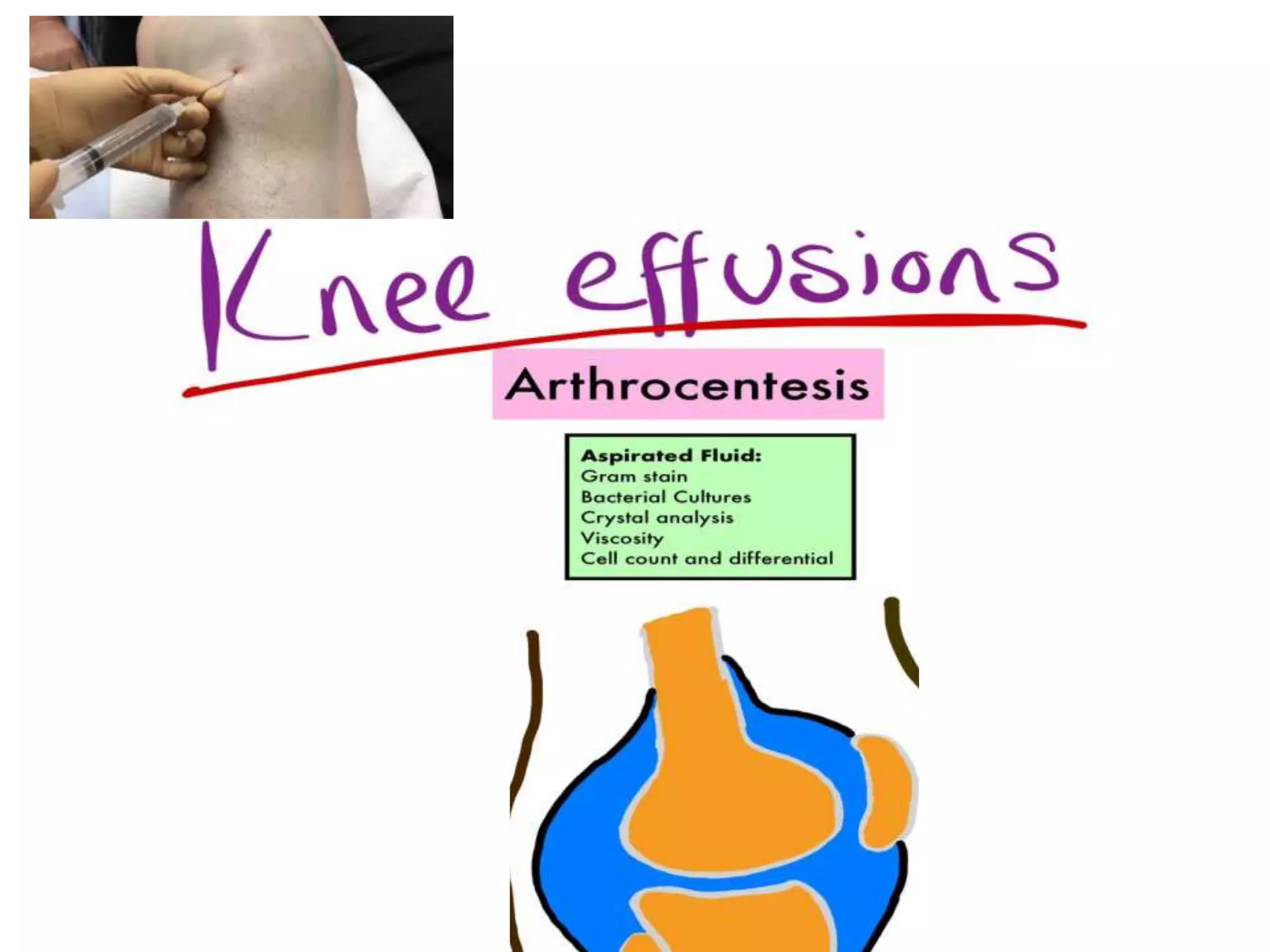 CNS Rheumatology Revision.pptx