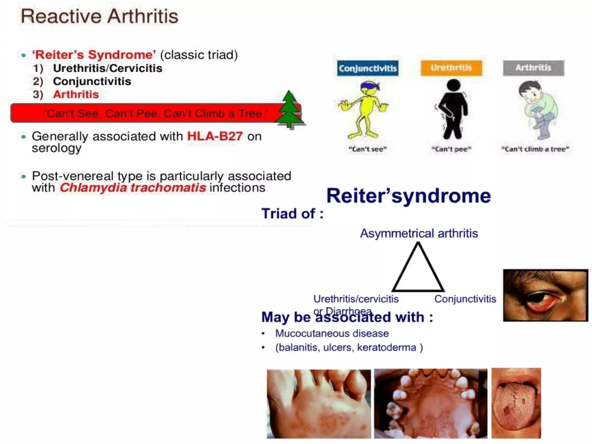 CNS Rheumatology Revision.pptx