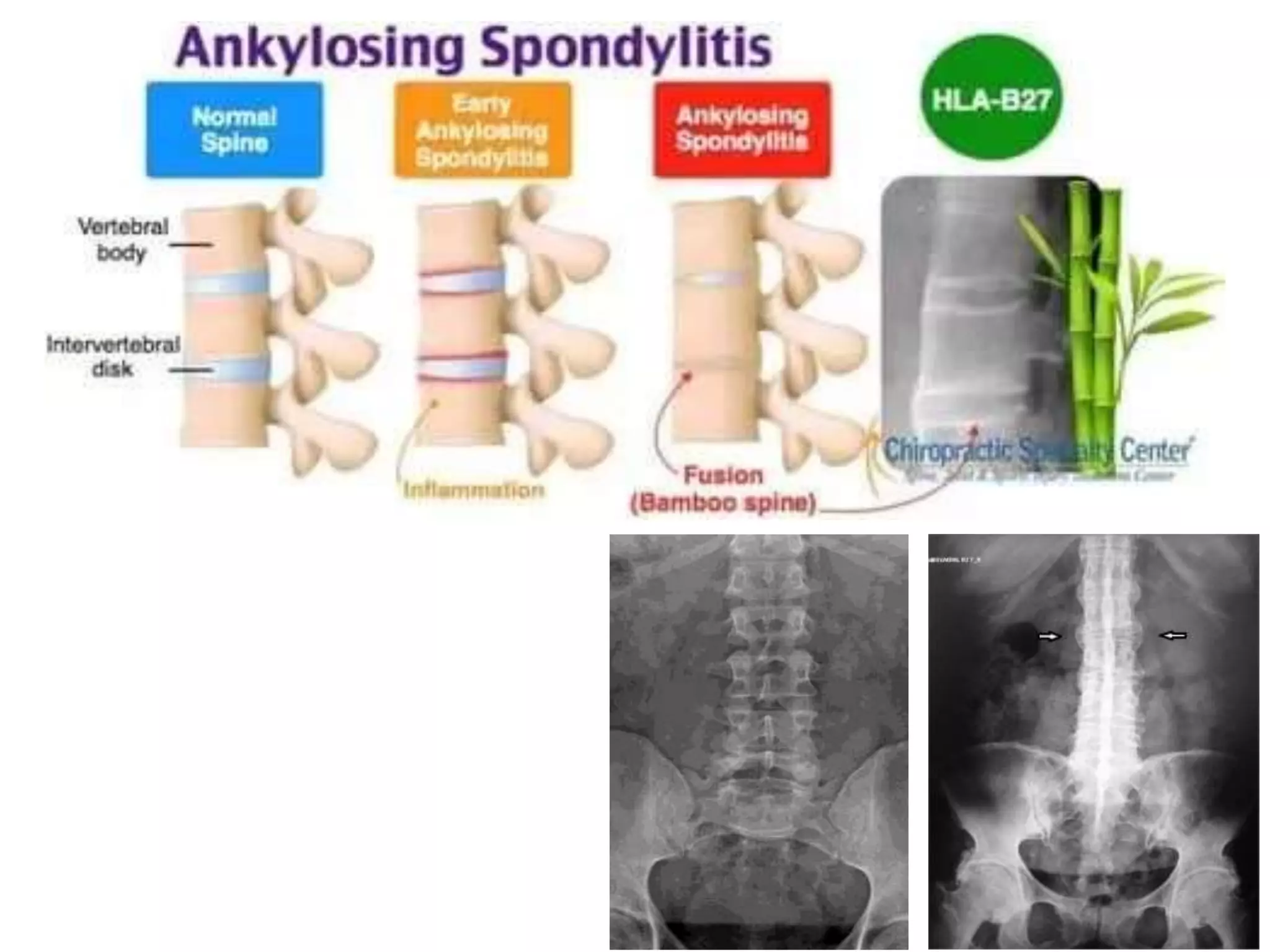 CNS Rheumatology Revision.pptx