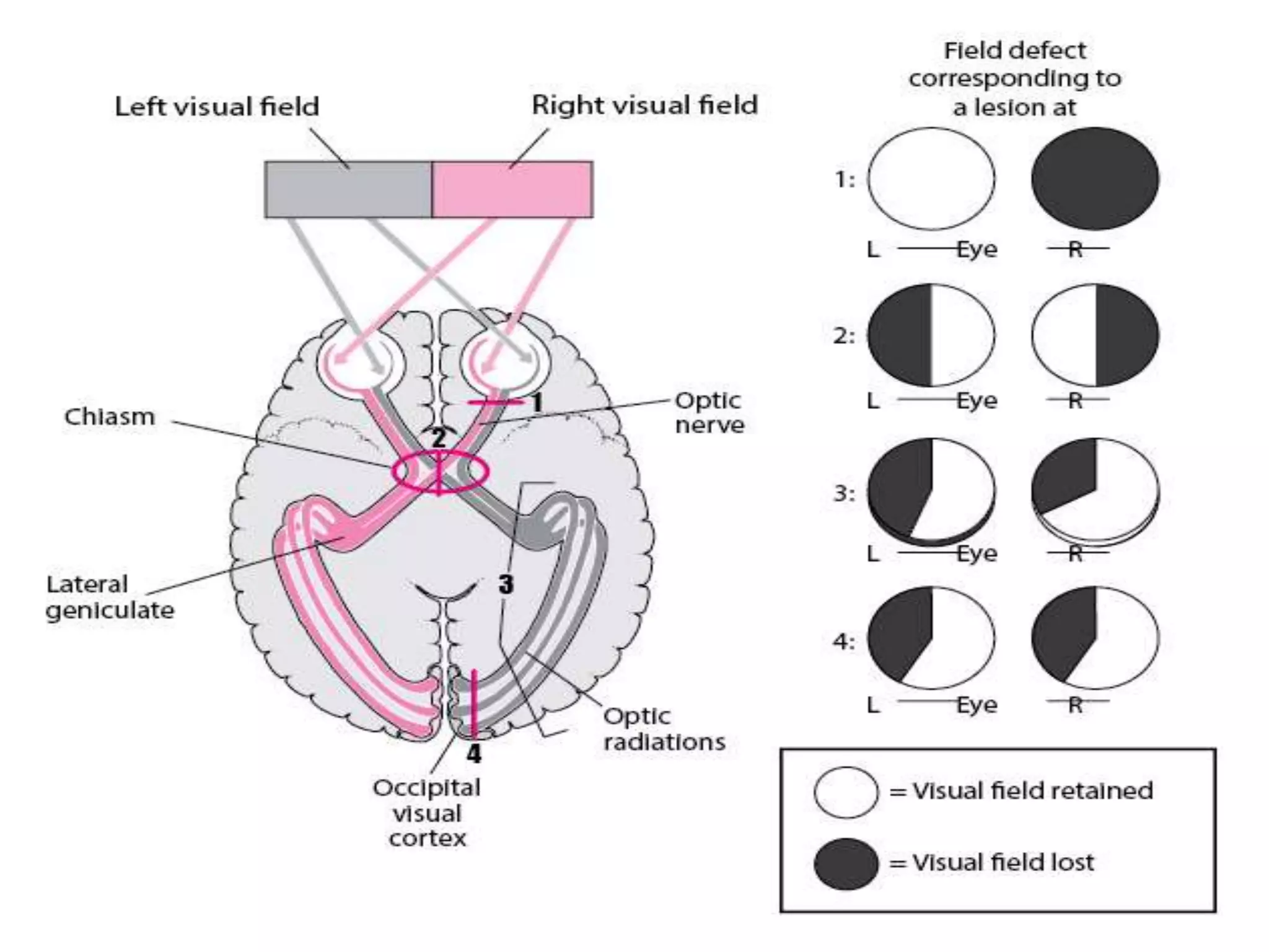 CNS Rheumatology Revision.pptx
