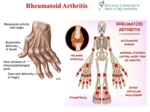 CNS Rheumatology Revision.pptx