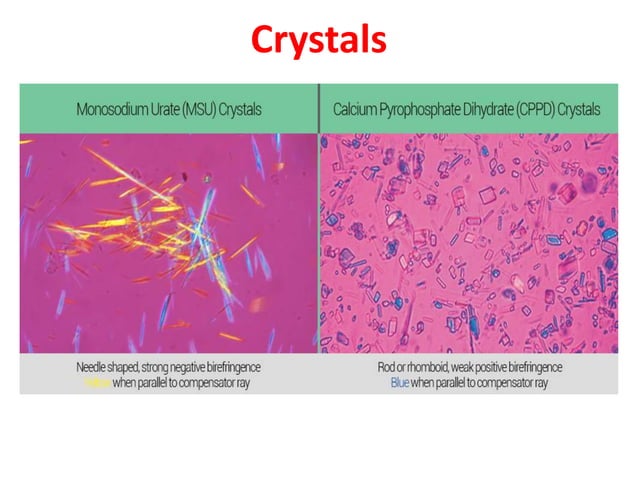CNS Rheumatology Revision.pptx