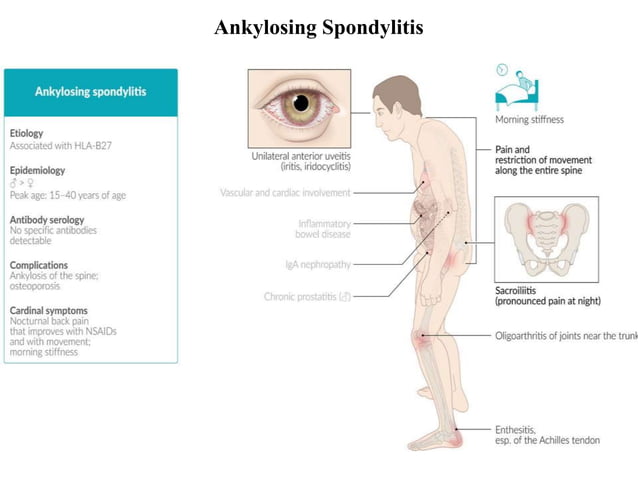 CNS Rheumatology Revision.pptx