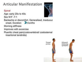 CNS Rheumatology Revision.pptx