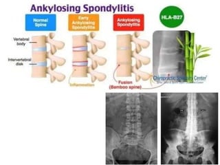 CNS Rheumatology Revision.pptx