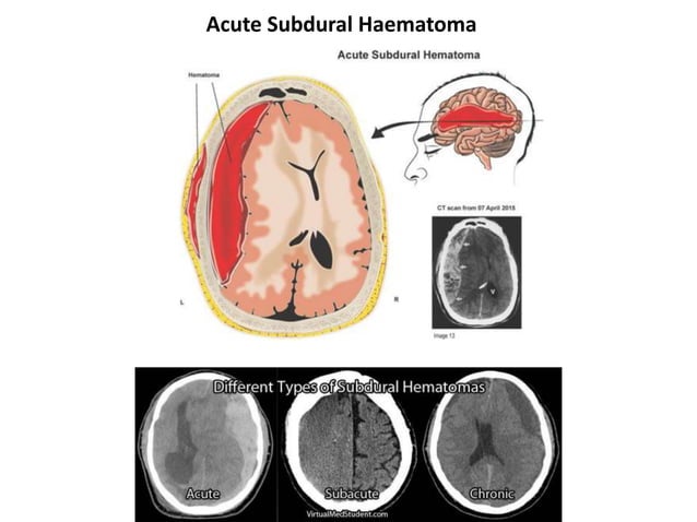 CNS Rheumatology Revision.pptx