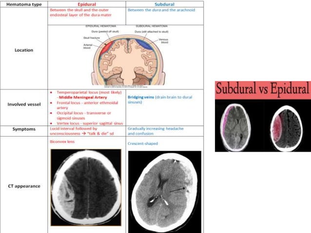 CNS Rheumatology Revision.pptx
