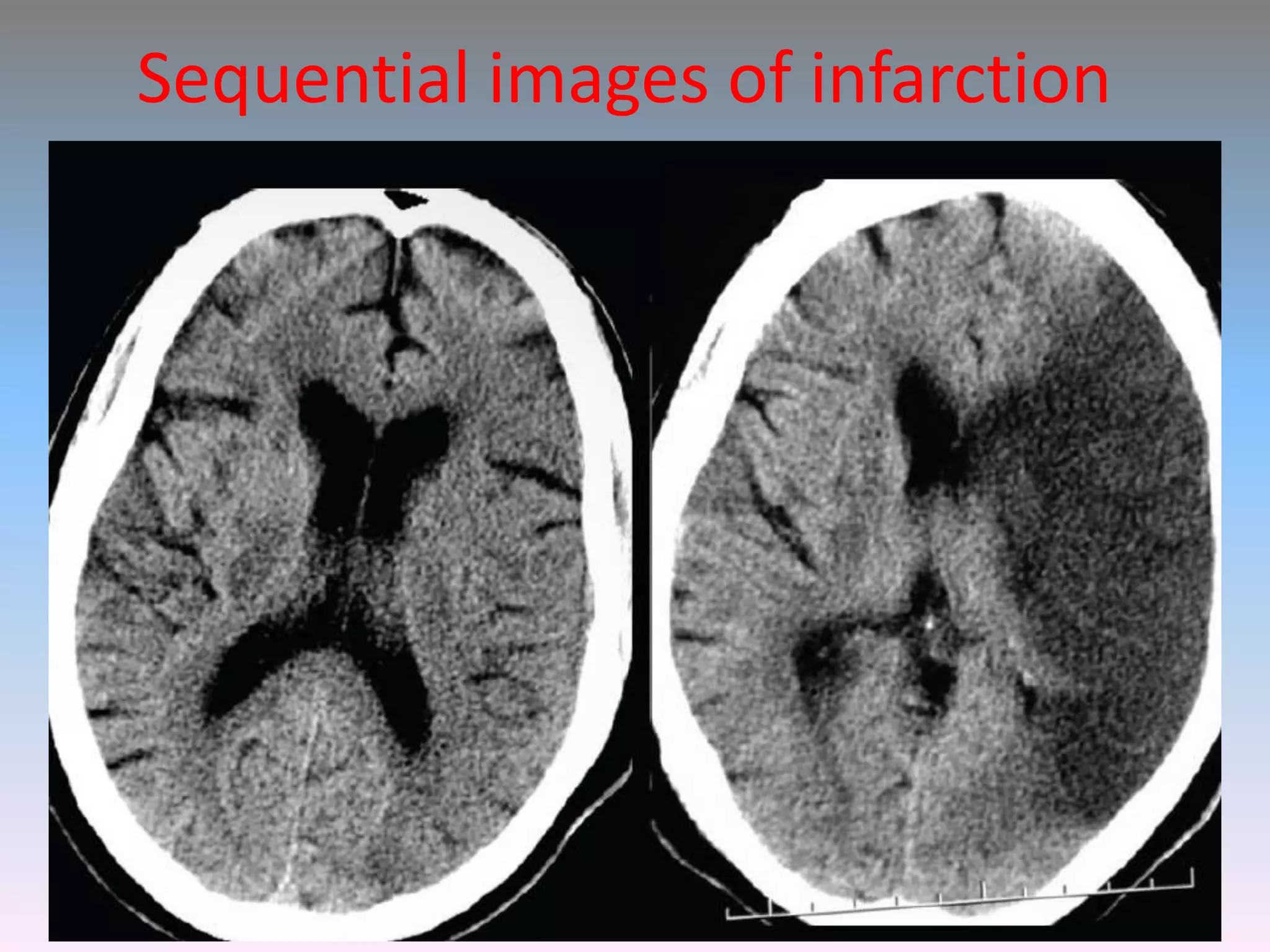 CNS Imaging for Medical Students | PPTX