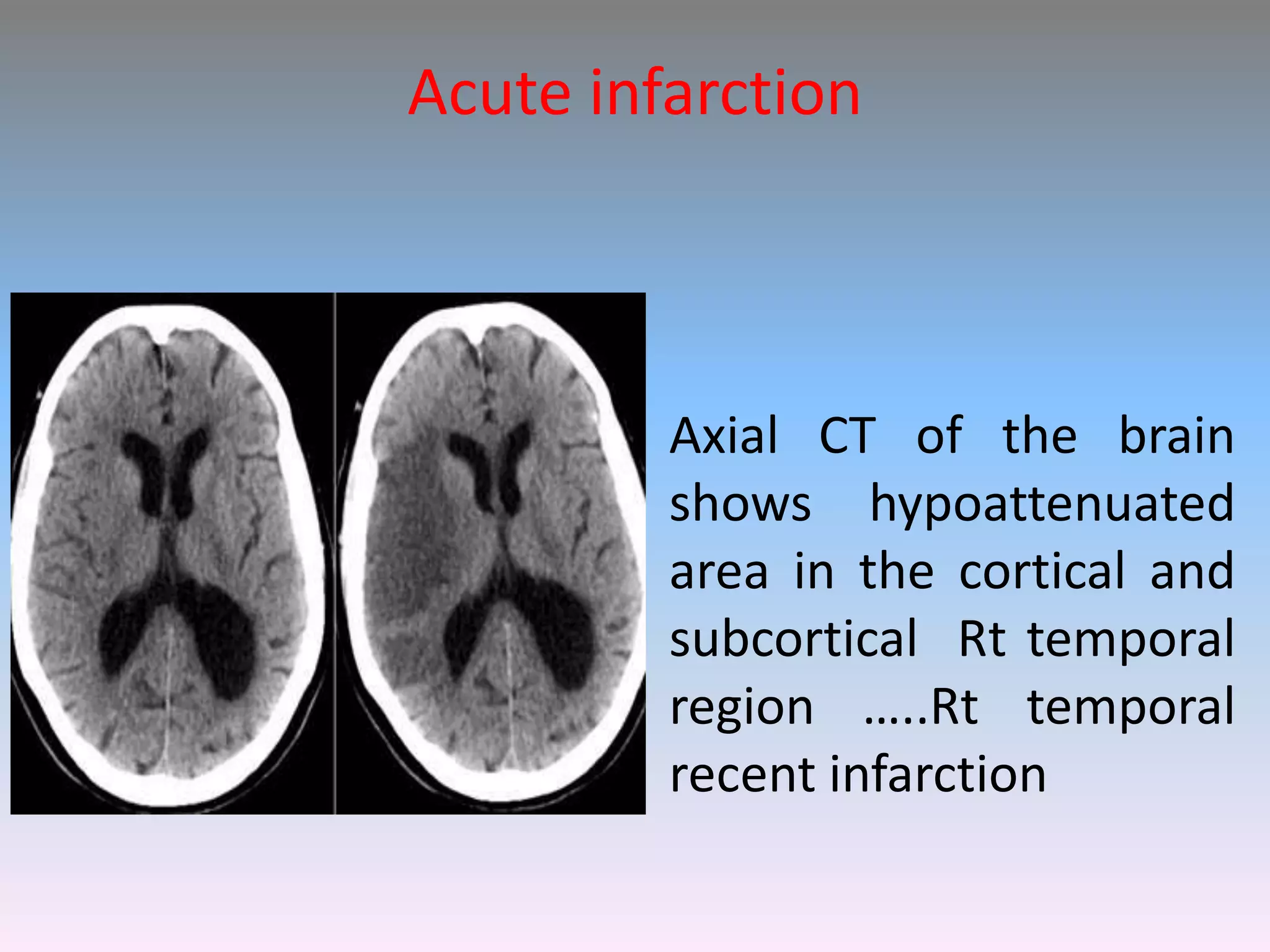 CNS Imaging for Medical Students | PPTX