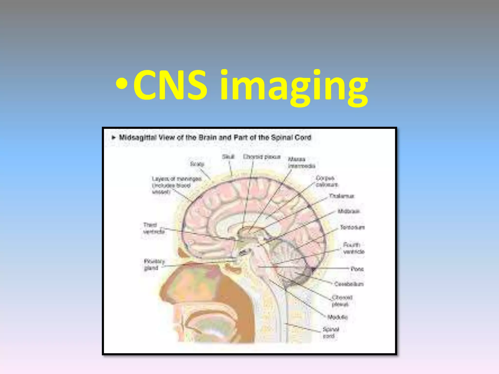 CNS Imaging for Medical Students | PPTX