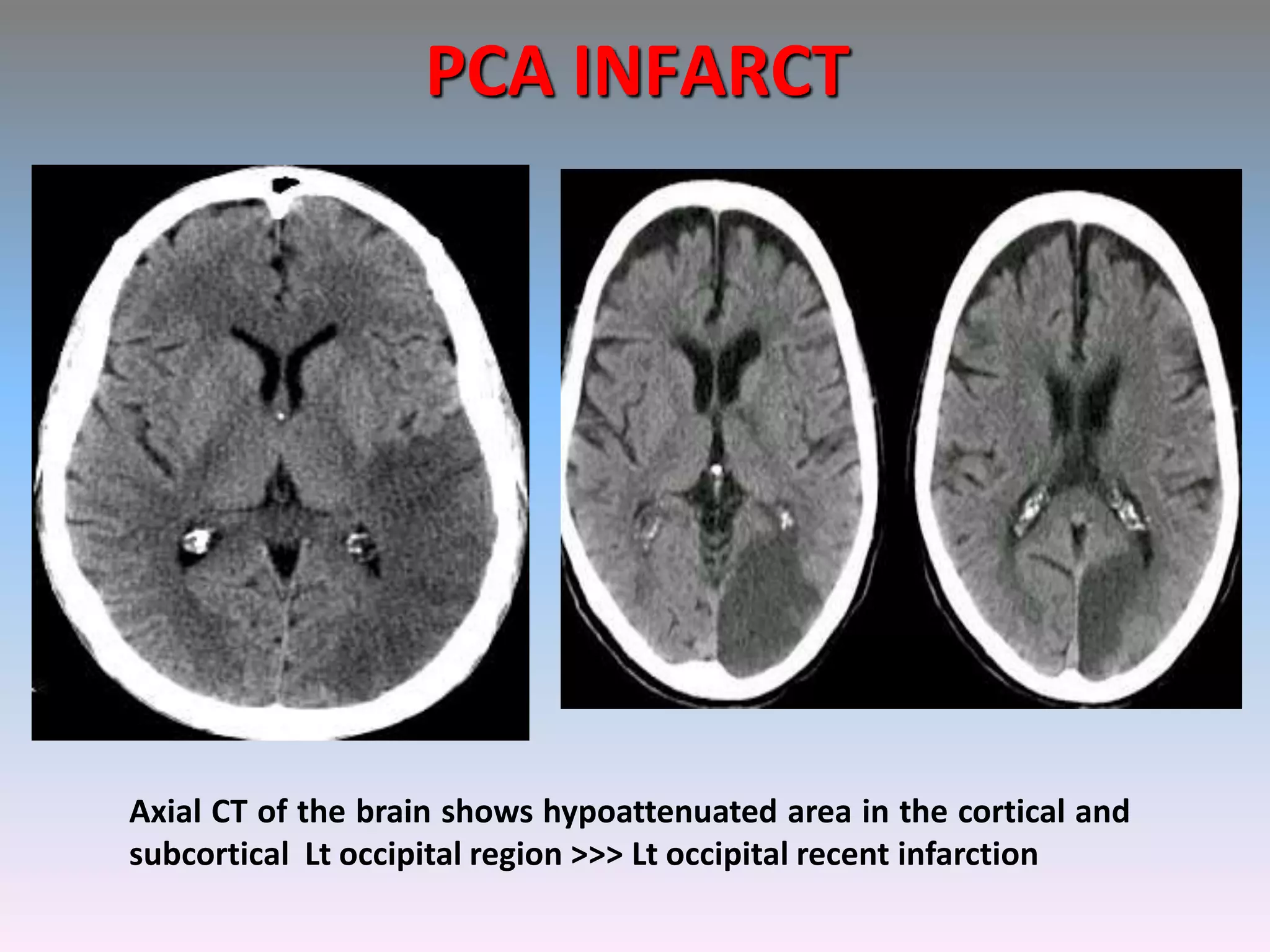 CNS Imaging for Medical Students | PPTX