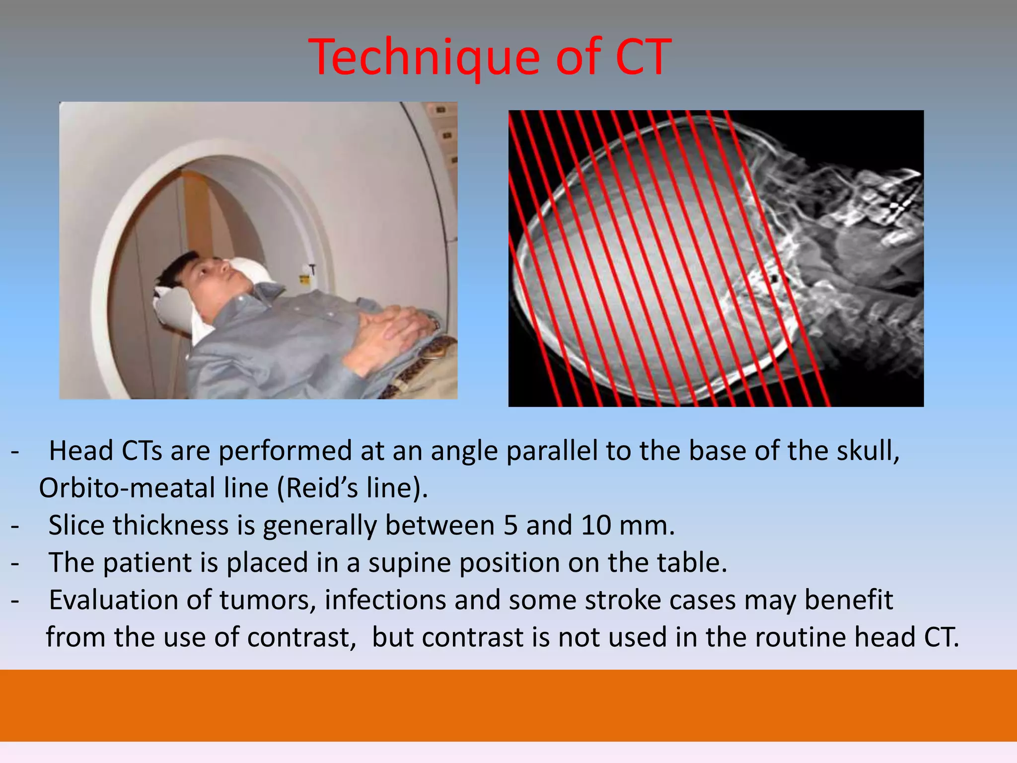 CNS Imaging for Medical Students | PPTX