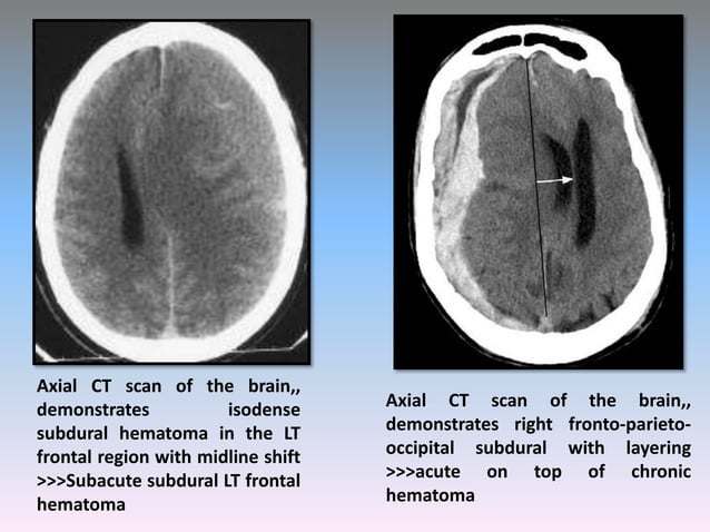 CNS Imaging for Medical Students | PPTX