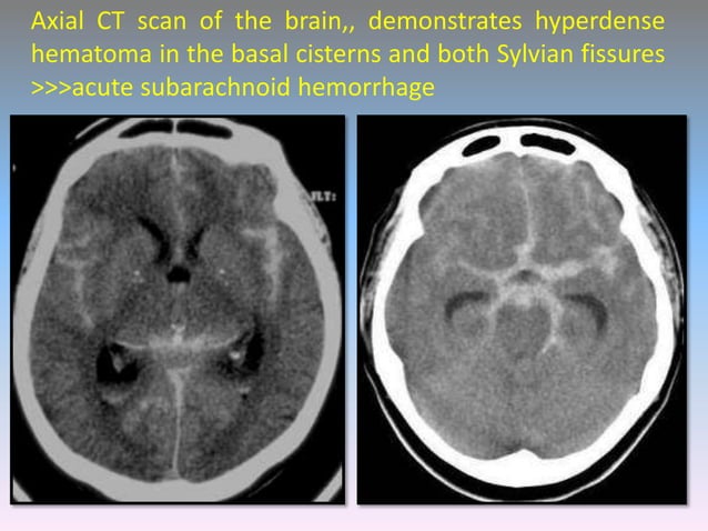 CNS Imaging for Medical Students | PPTX