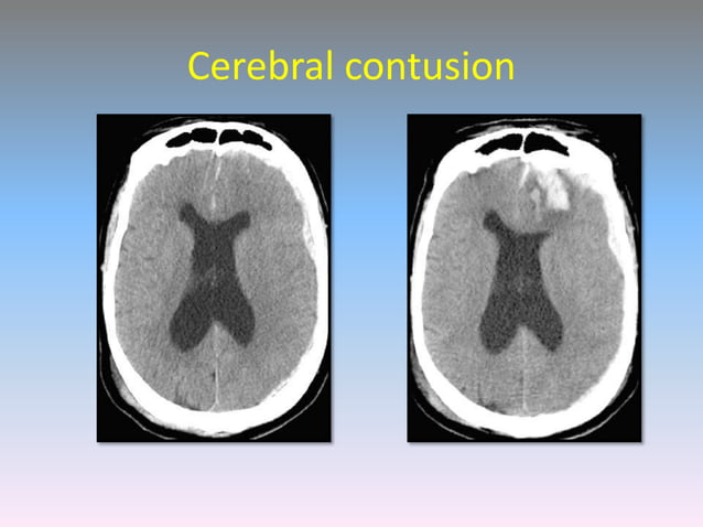 CNS Imaging for Medical Students | PPTX