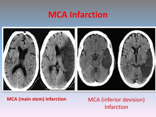 CNS Imaging for Medical Students | PPTX