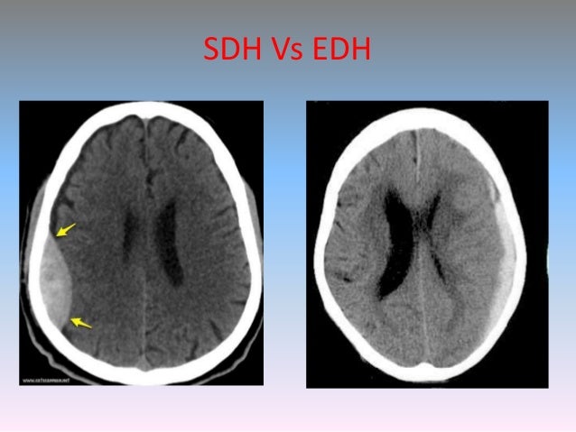 CNS Imaging for Medical Students