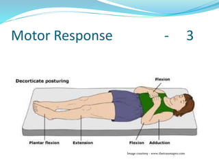 Glasgow coma scale.pptx