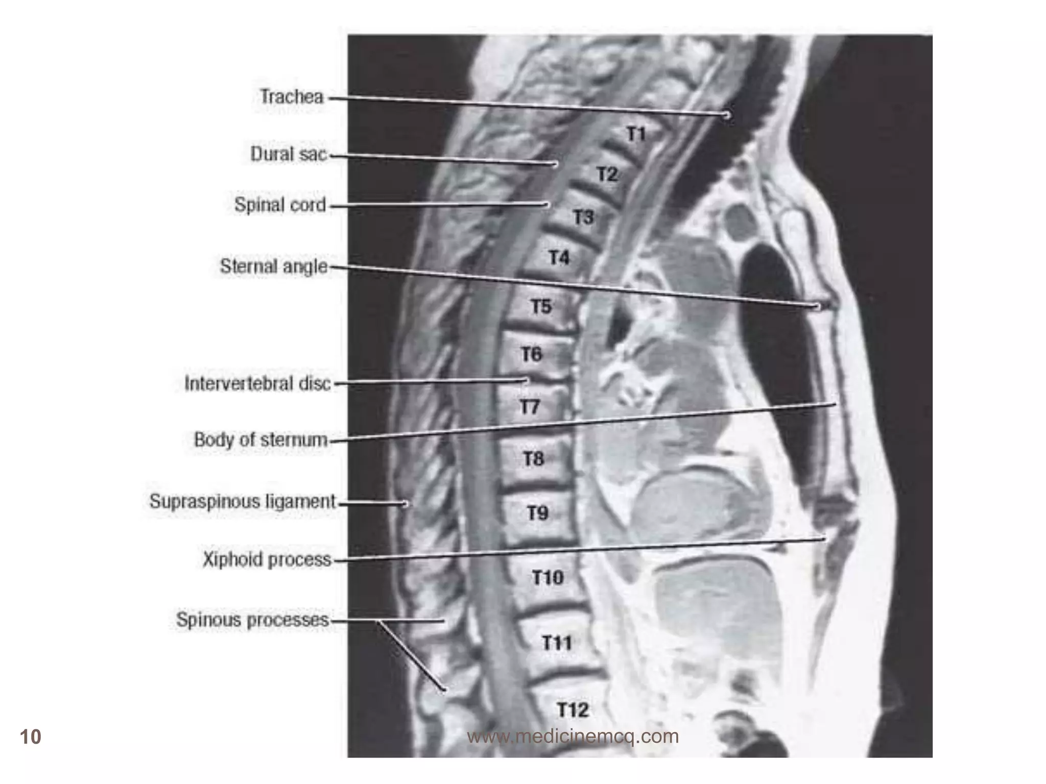 Spinal cord diseases | PPTX