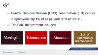 Central Nervous System Tuberculosis | PPTX