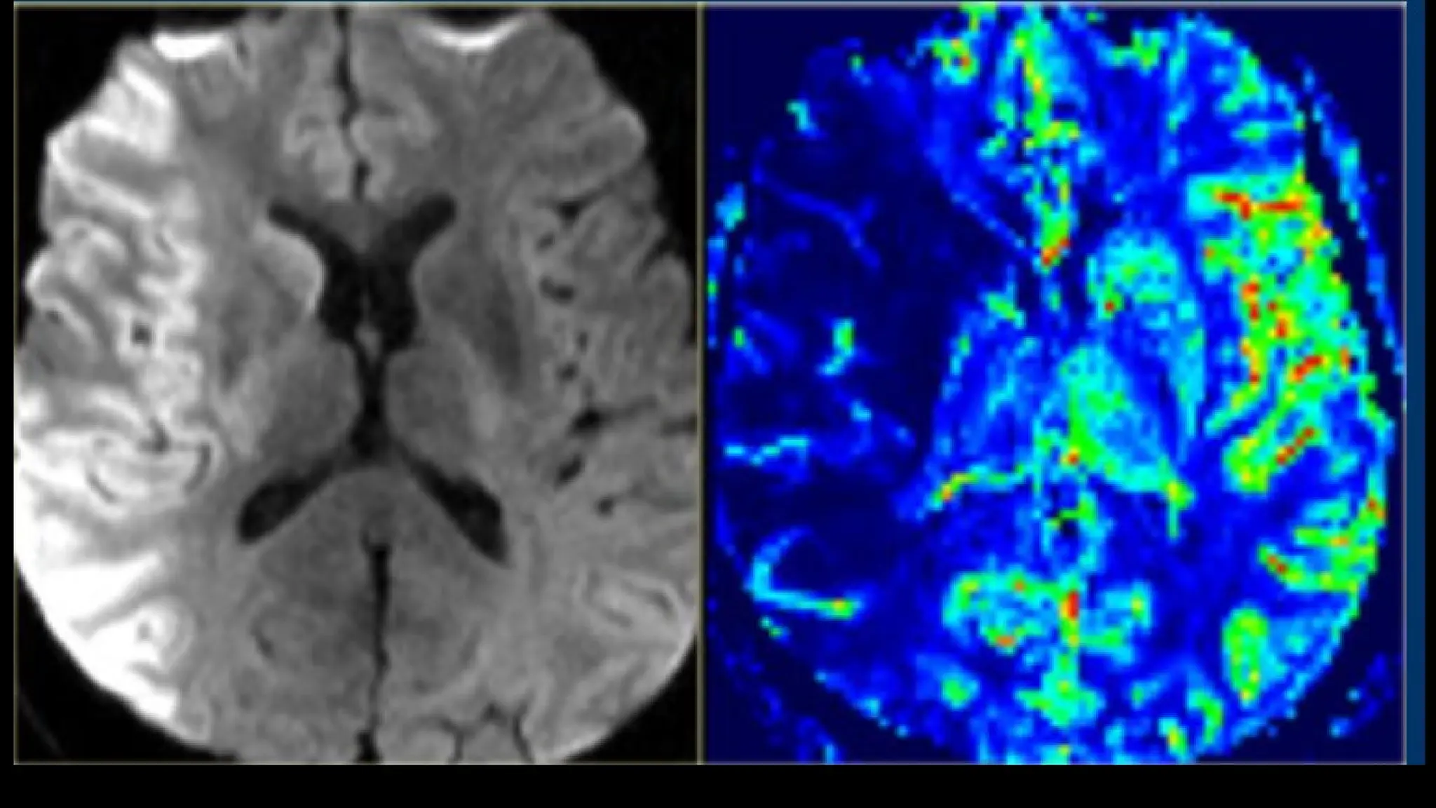 radiological imaging of the central nervous system.pptx