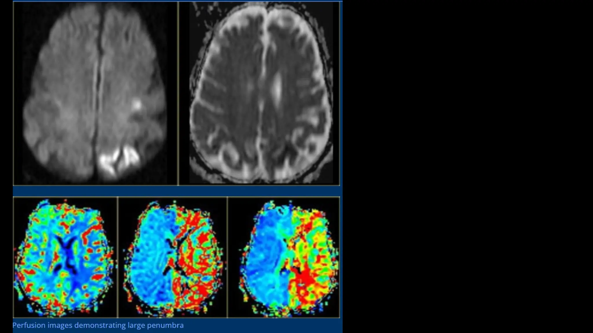 radiological imaging of the central nervous system.pptx