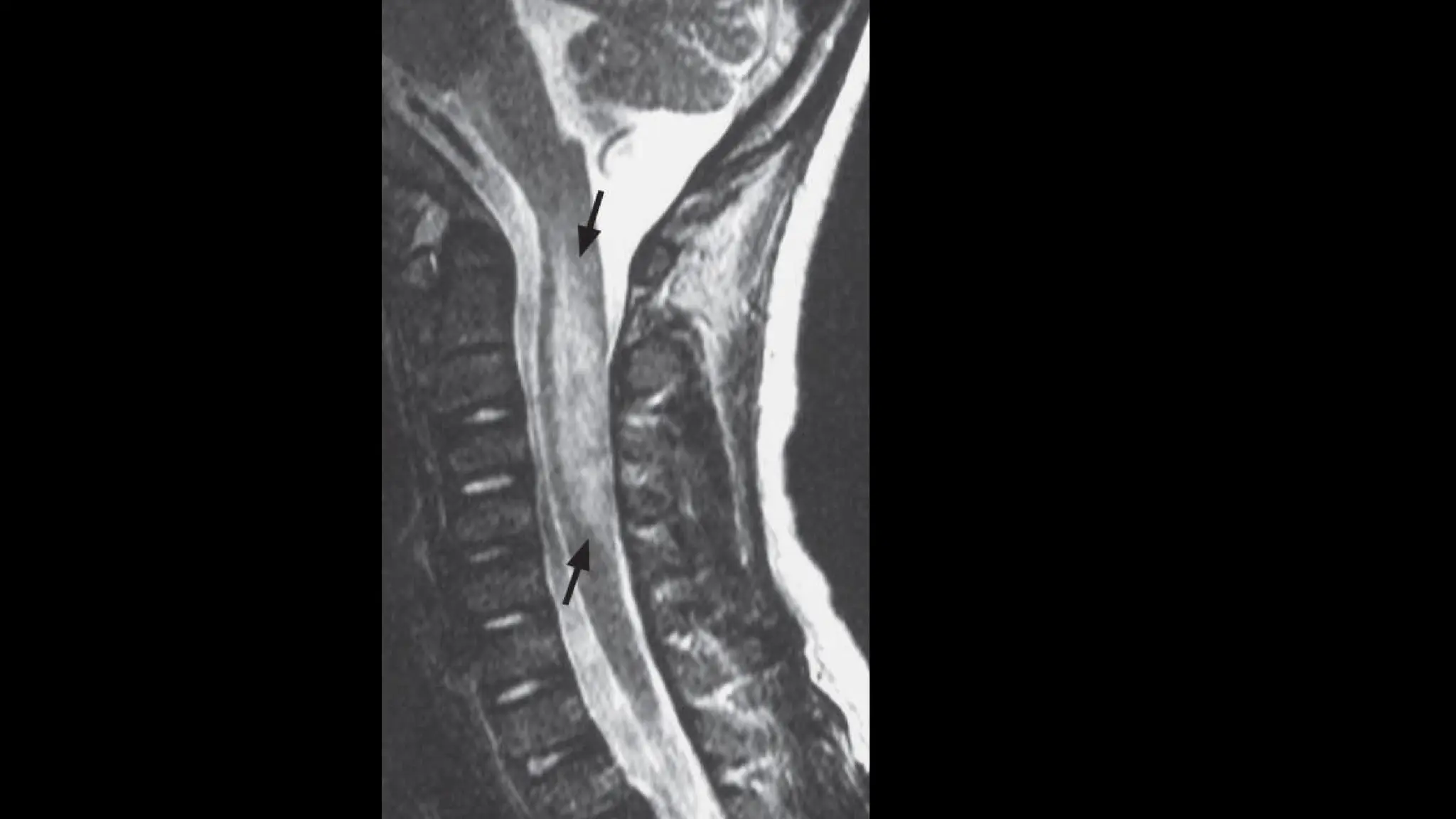 radiological imaging of the central nervous system.pptx