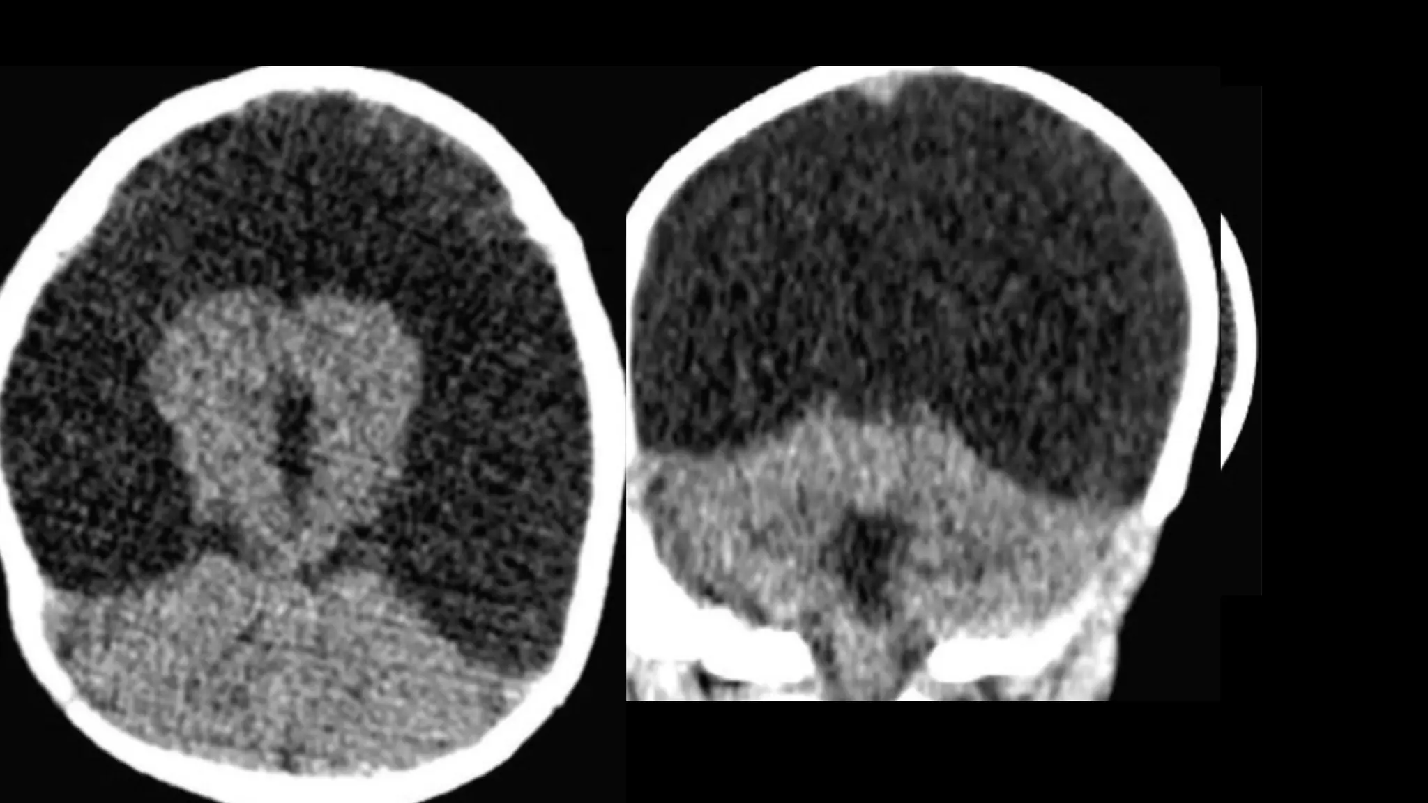 radiological imaging of the central nervous system.pptx