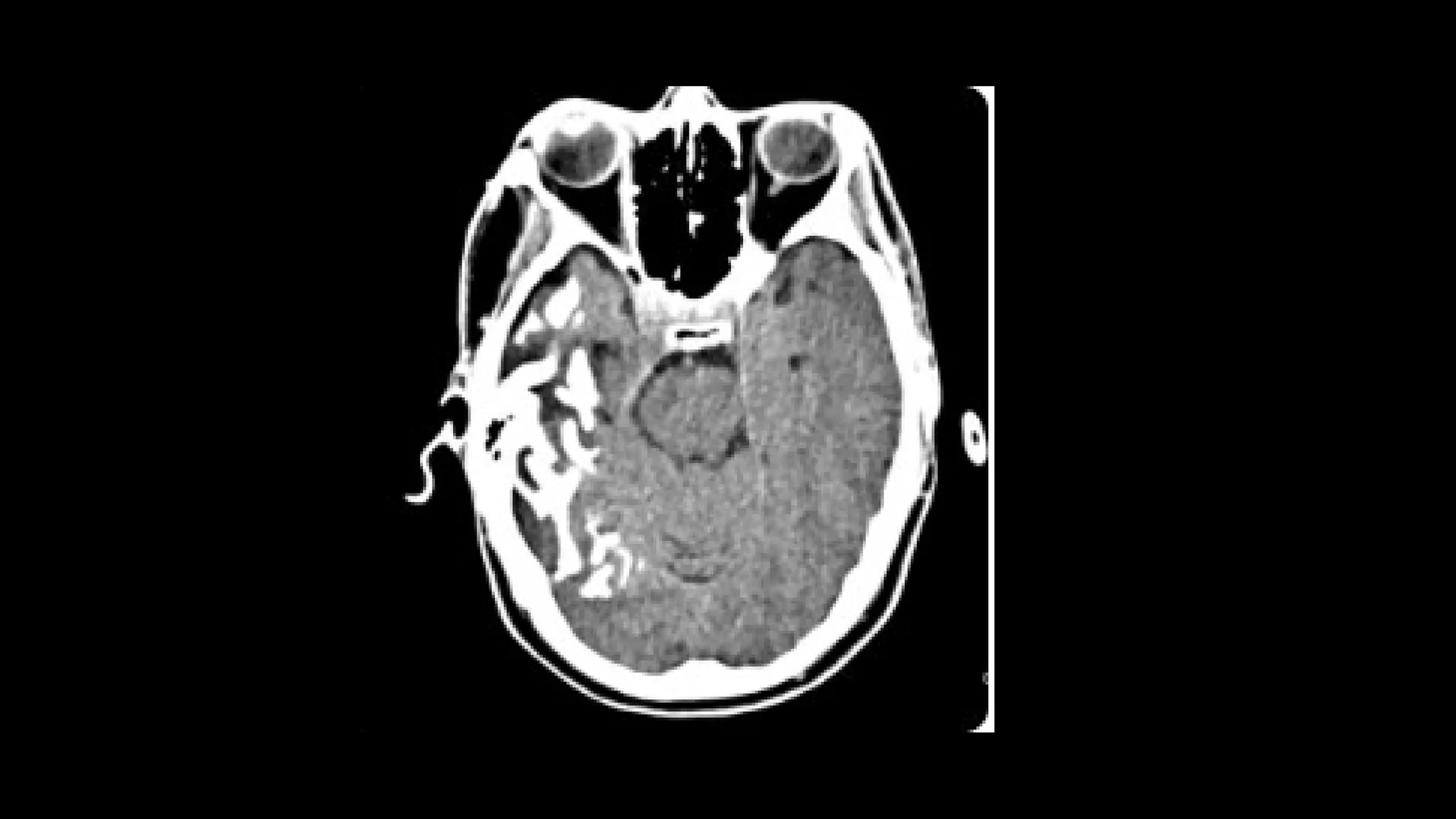radiological imaging of the central nervous system.pptx