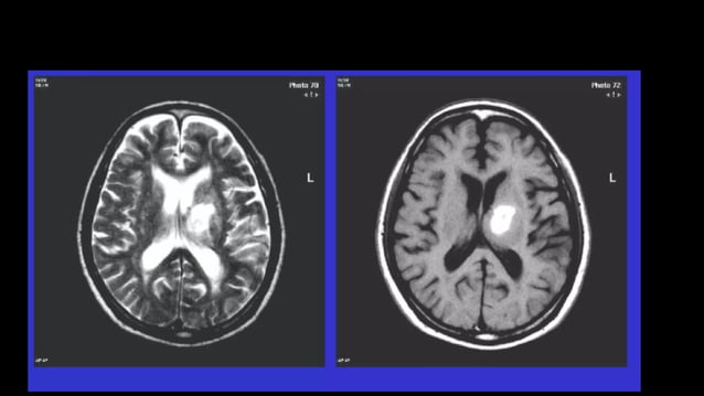 radiological imaging of the central nervous system.pptx