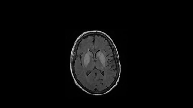 radiological imaging of the central nervous system.pptx
