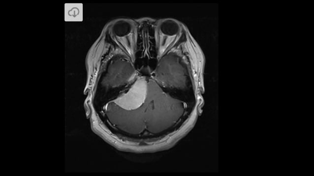 radiological imaging of the central nervous system.pptx