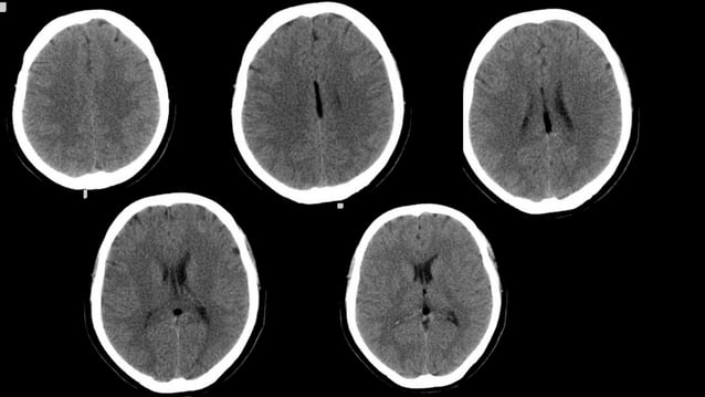 radiological imaging of the central nervous system.pptx