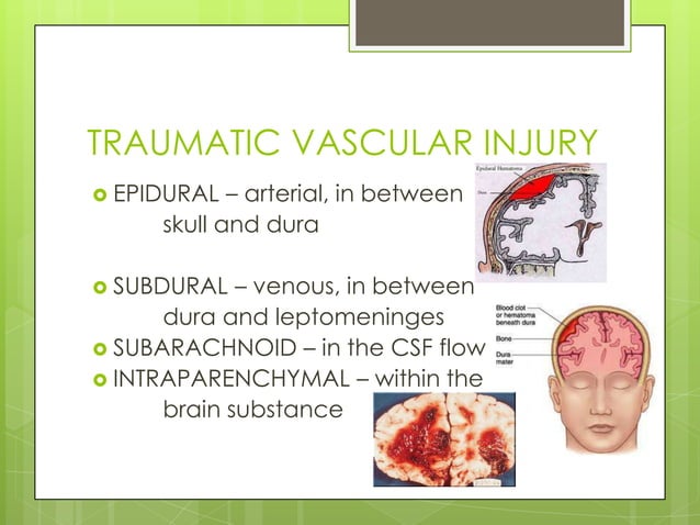 CNS Trauma | PPTX
