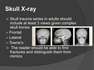 Cns trauma | PPTX