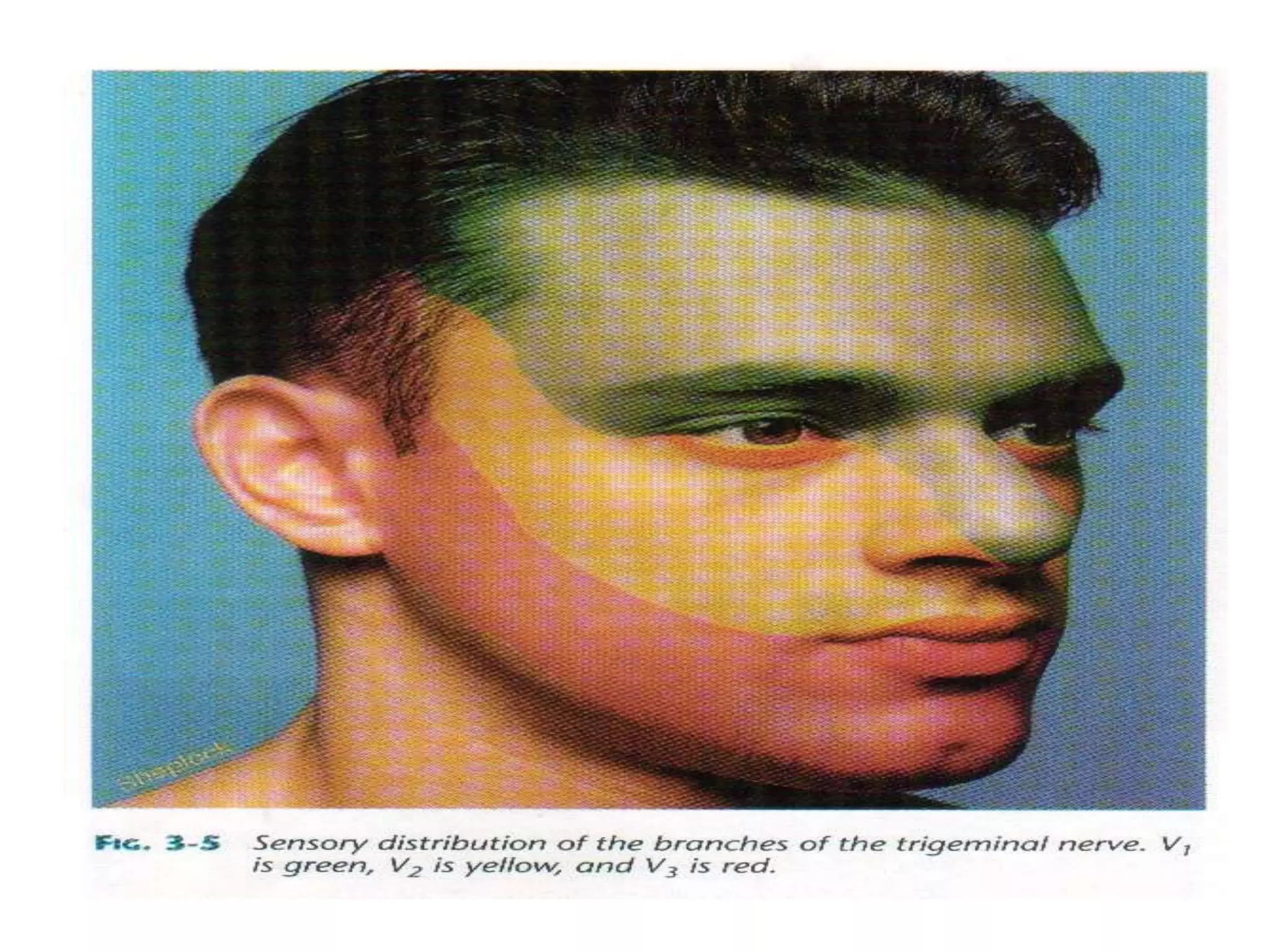 Cranial Nerve V Trigemial | PPTX