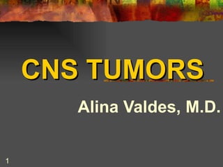 CNS Tumors | PPT