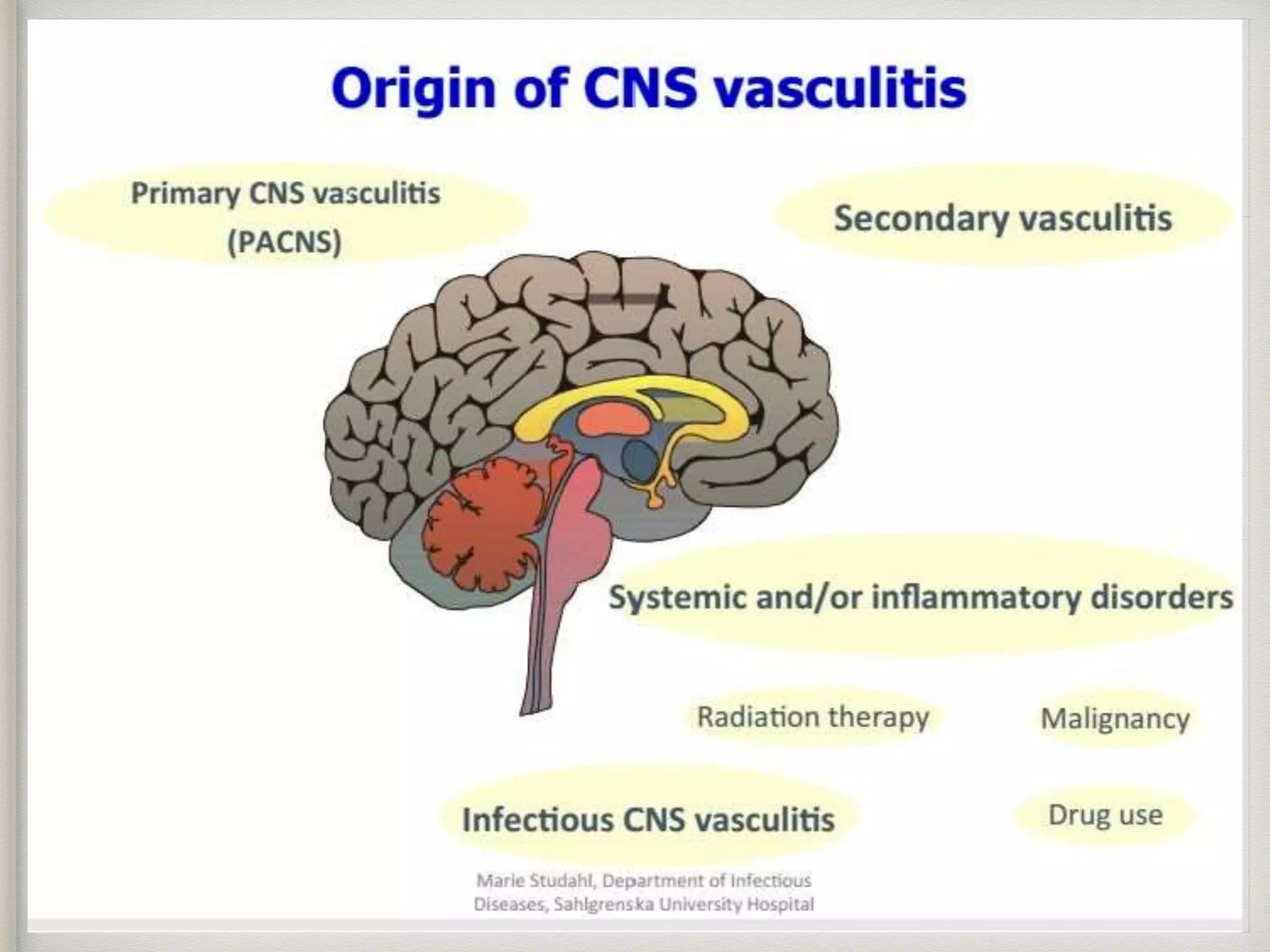 CNS Vasculitis - Primary Vs Secondary | PPT