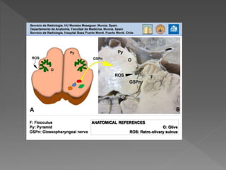 Imaging in Neurovascular conflicts [Neurovascular compression syndrome ...