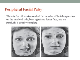 Cranial Nerve VII - Facial Nerve (Nervus facialis) | PPTX