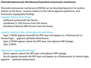 Choroidal Neovascular Membrane Diagram