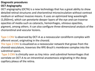 Choroidal neovascular membranes (CNVM) | PPT