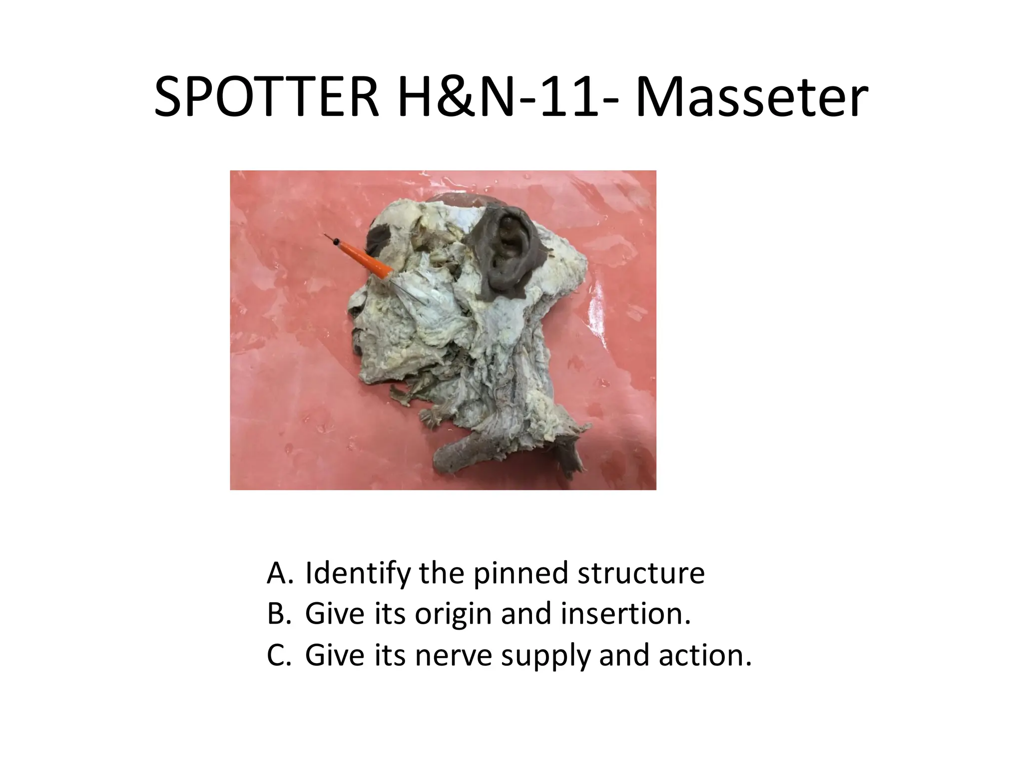 spotters_h_and_n.pdf important spotters. | PPT