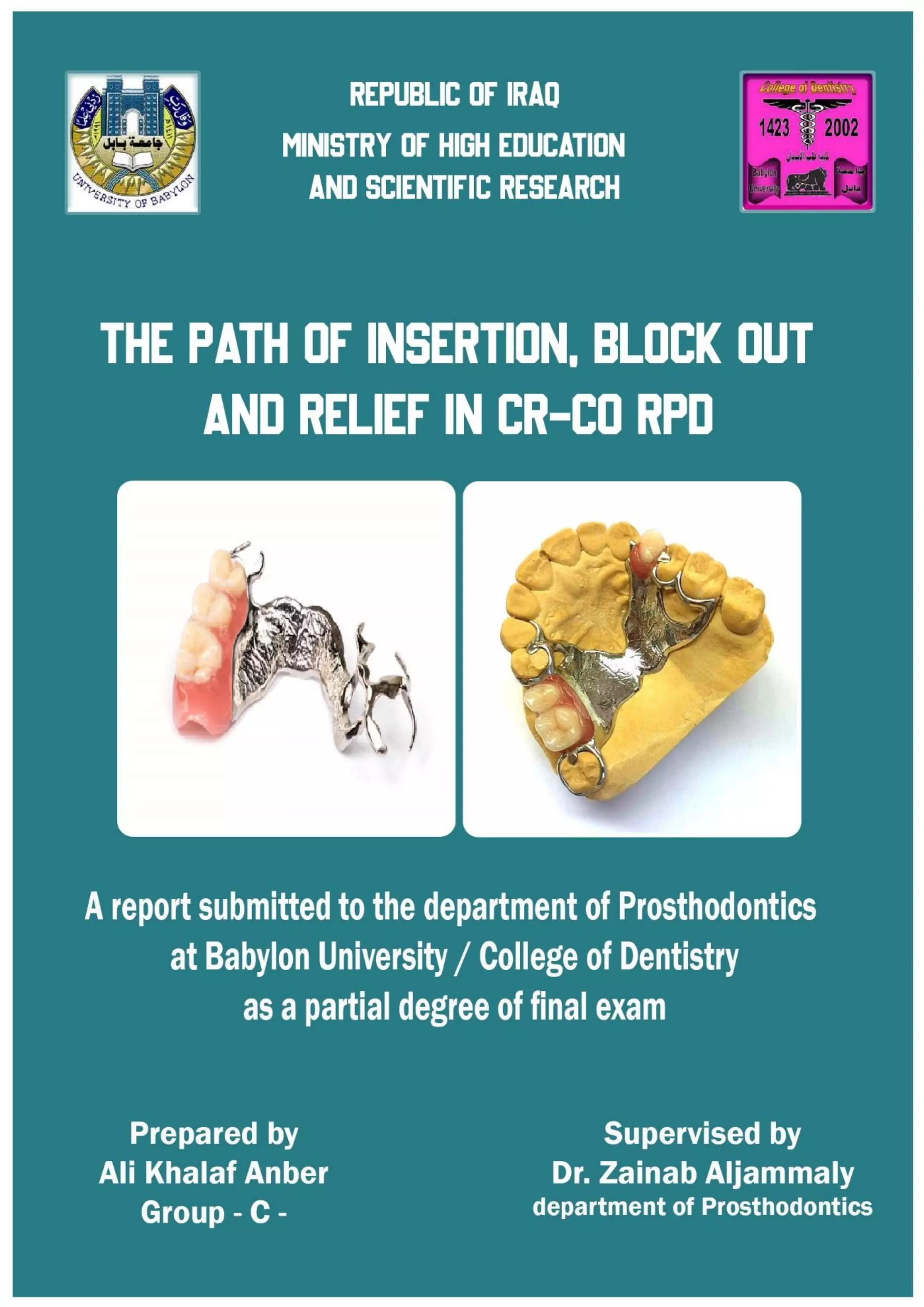Co Cr RBD / the path of insertion, block out and relief | PDF