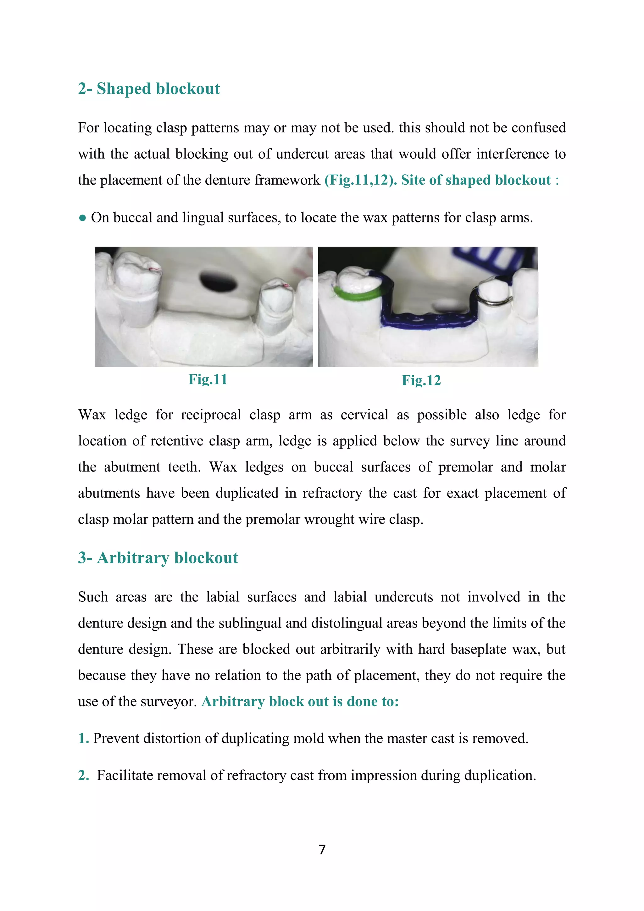 Co Cr RBD / the path of insertion, block out and relief | PDF