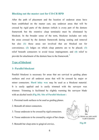 Co Cr RBD / the path of insertion, block out and relief | PDF