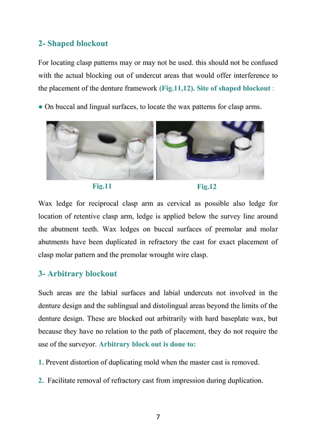 Co Cr RBD / the path of insertion, block out and relief | PDF | Dental ...