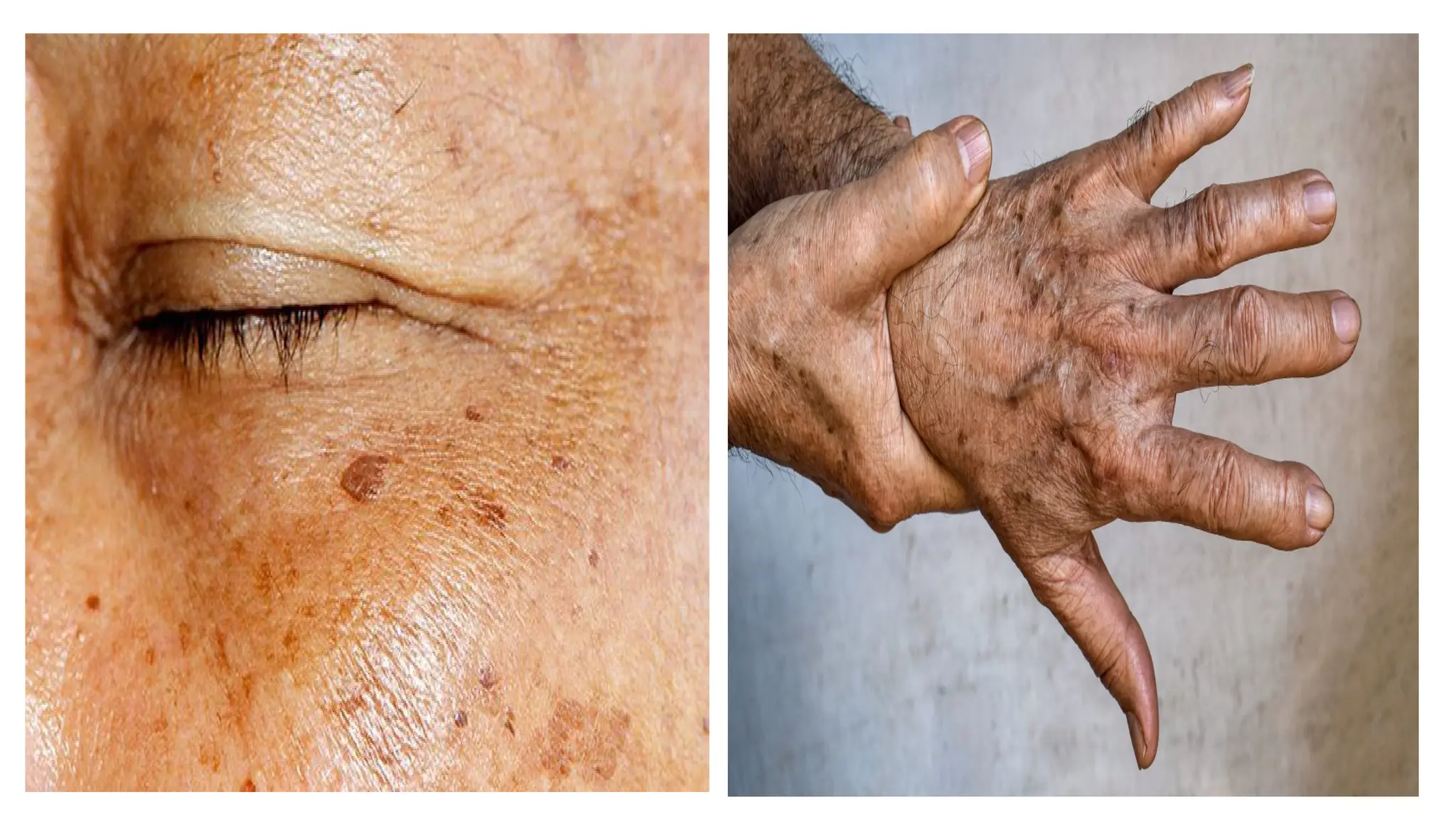 organ systems ; integumentary system; skin and fascia | PPTX | Skin and ...