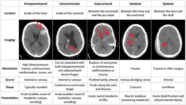 meninges, Dural sinuses and CSF circulation.pptx